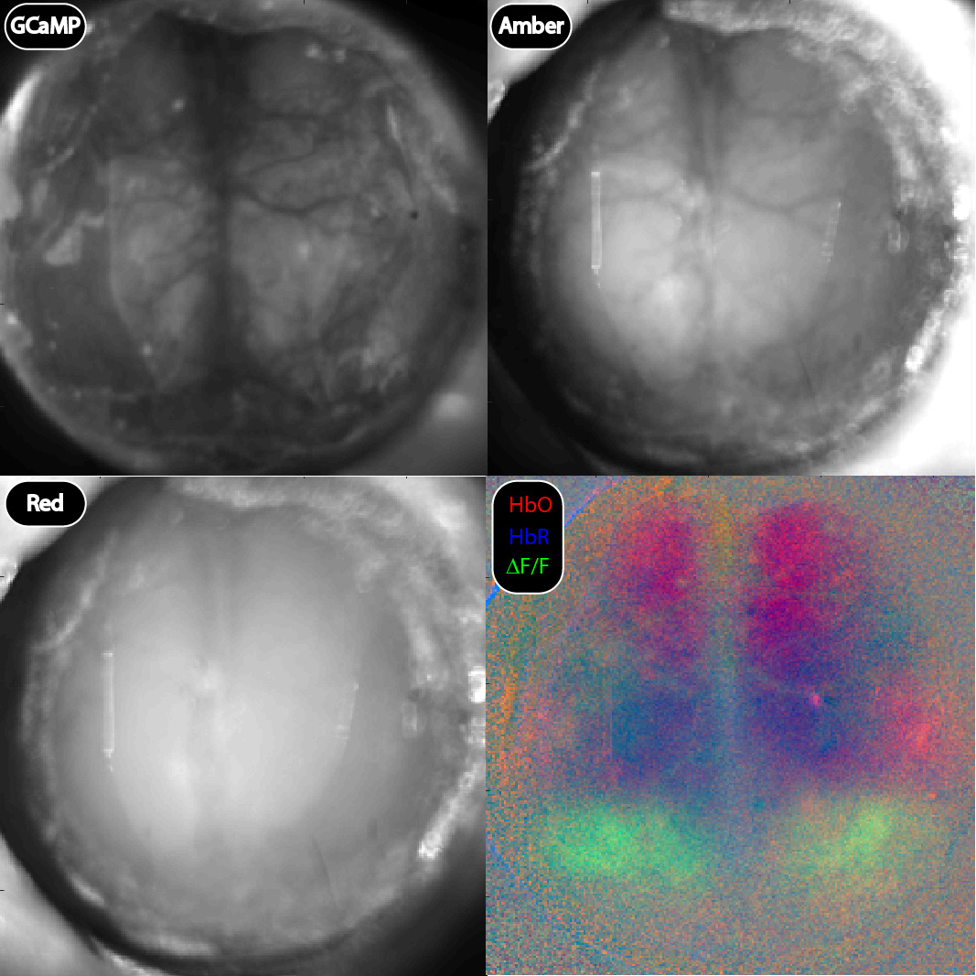 Modular Optical Imaging System - LabeoTech