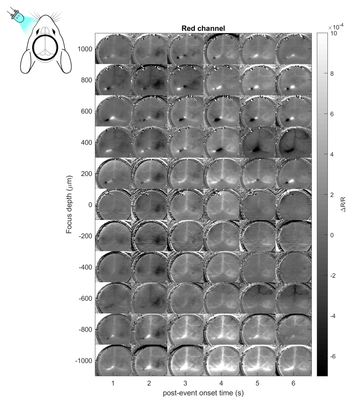 Retinotopic mapping