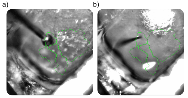 Optical Imaging for Accurate Probe Targeting in Mouse Cortex
