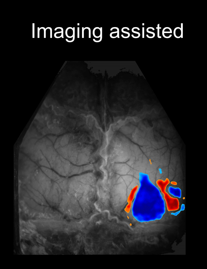 Optical Imaging for Accurate Probe Targeting in Mouse Cortex