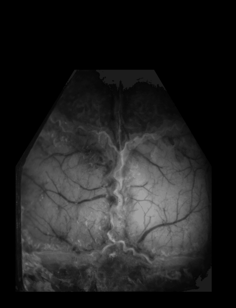 Optical Imaging for Accurate Probe Targeting in Mouse Cortex